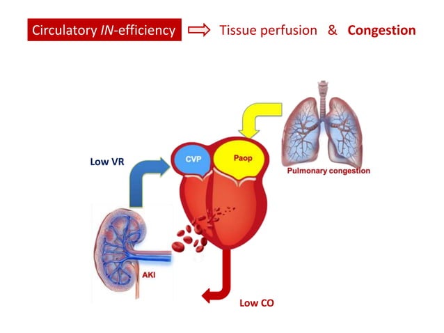 15. hemodynamic monitoring during ecmo #beach2019 (bouchez) | PPT