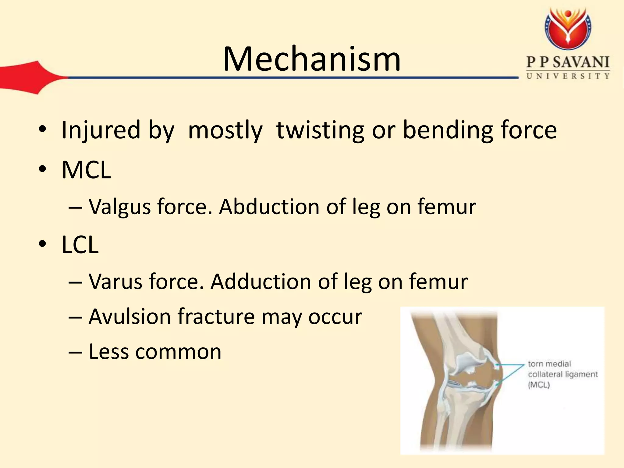 15. Knee ligament injury | PPTX