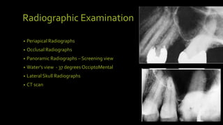Odontogenic Diseases of the Maxillary Sinus | PPTX