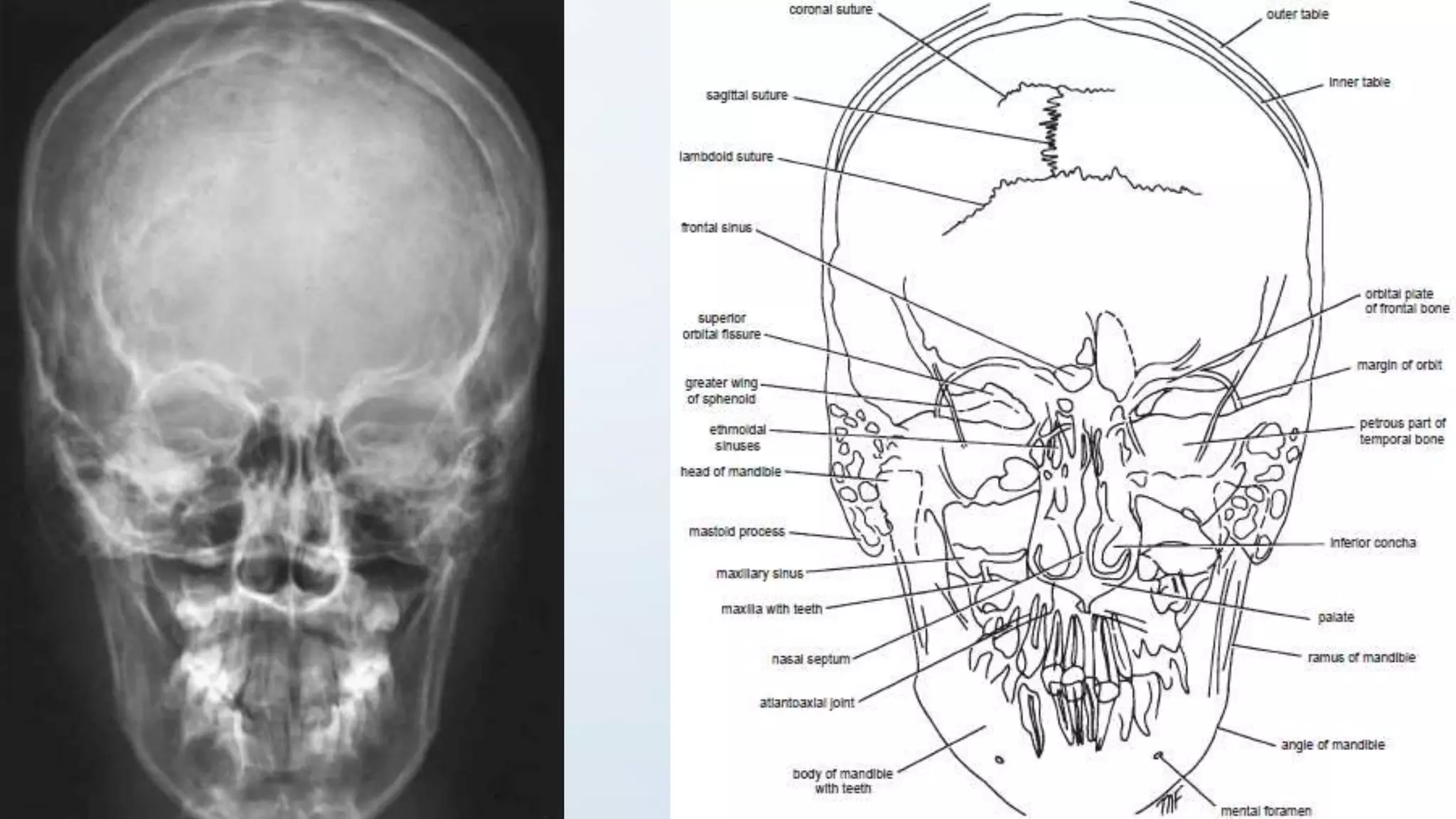 Radiographic Anatomy of the Head and Neck | PPTX