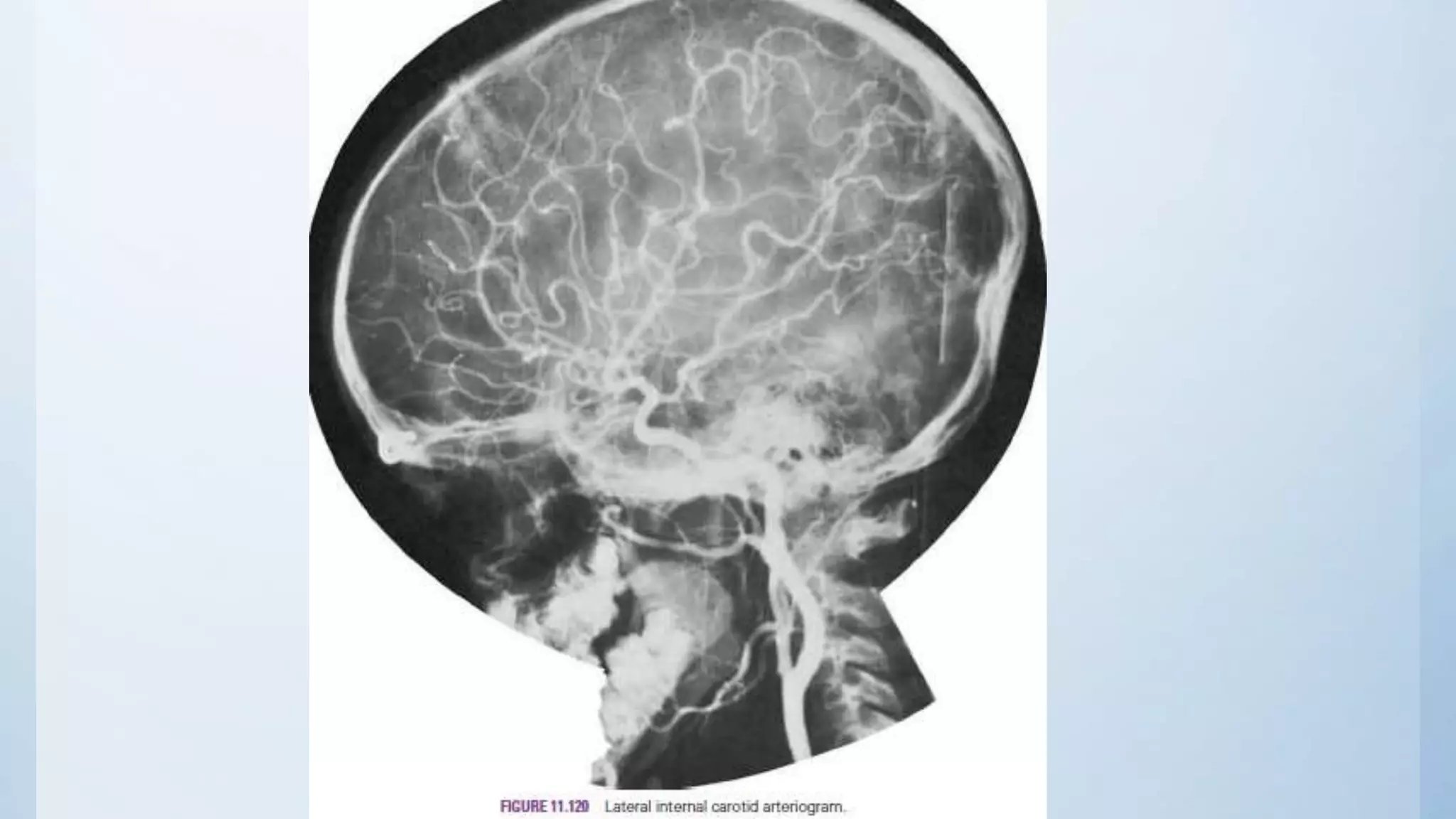 Radiographic Anatomy of the Head and Neck | PPTX