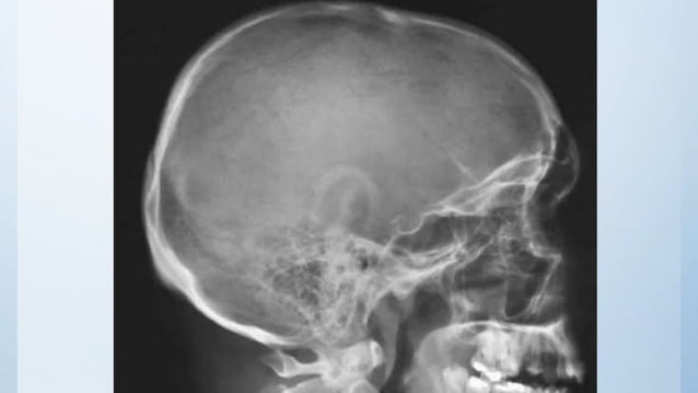 Radiographic Anatomy of the Head and Neck | PPTX