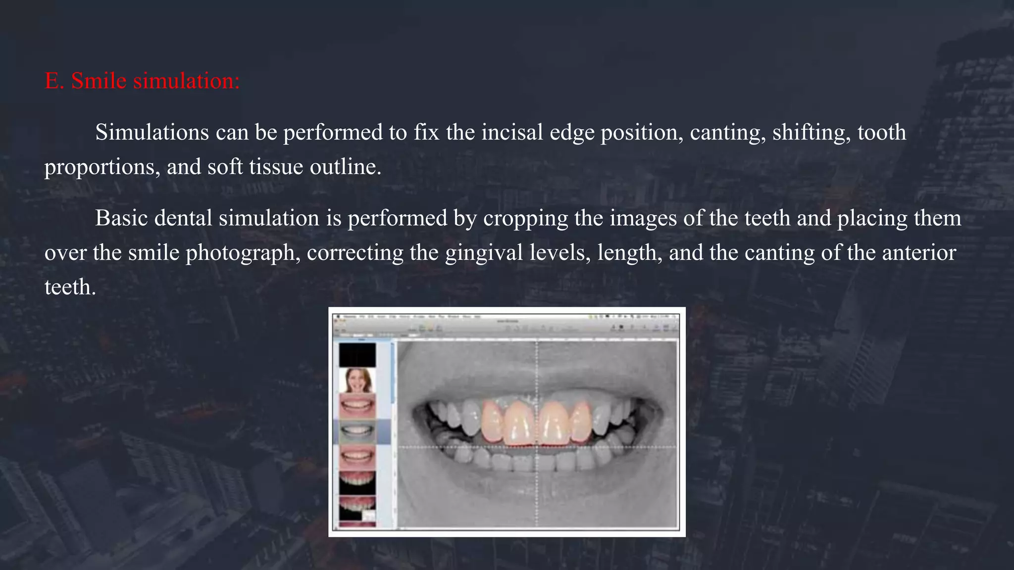 Digital Smile Designing | PPTX