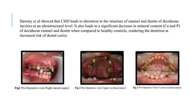Management of medically compromised patients | PPTX