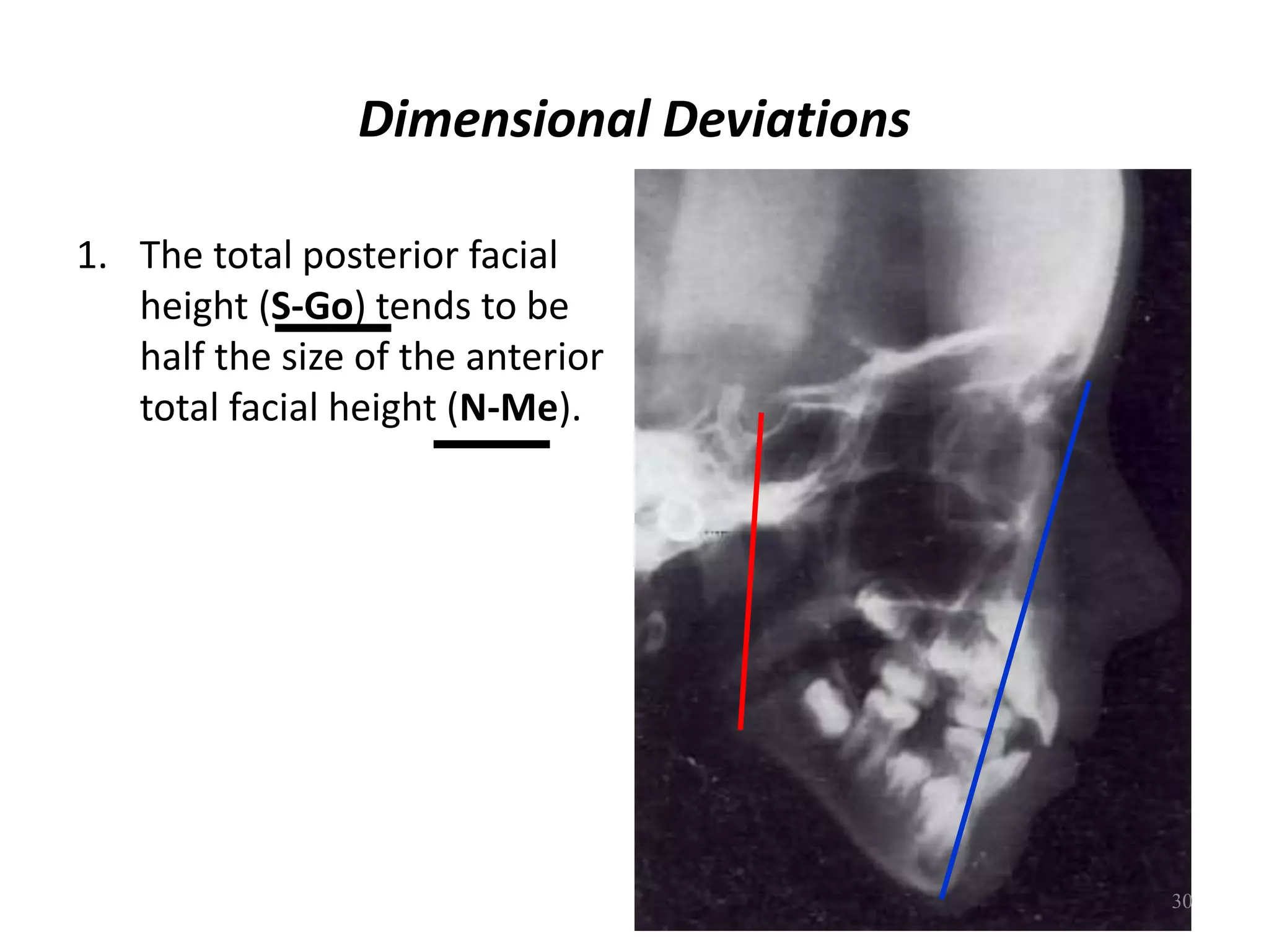 MANAGEMENT OF OPEN BITE | PPT