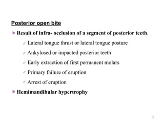 MANAGEMENT OF OPEN BITE | PPT