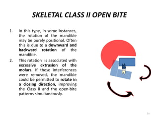 MANAGEMENT OF OPEN BITE | PPT