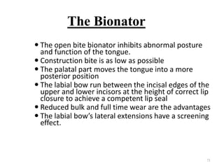 MANAGEMENT OF OPEN BITE | PPT