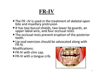 MANAGEMENT OF OPEN BITE | PPT