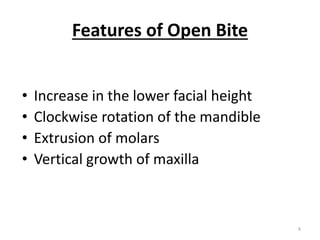 MANAGEMENT OF OPEN BITE | PPT