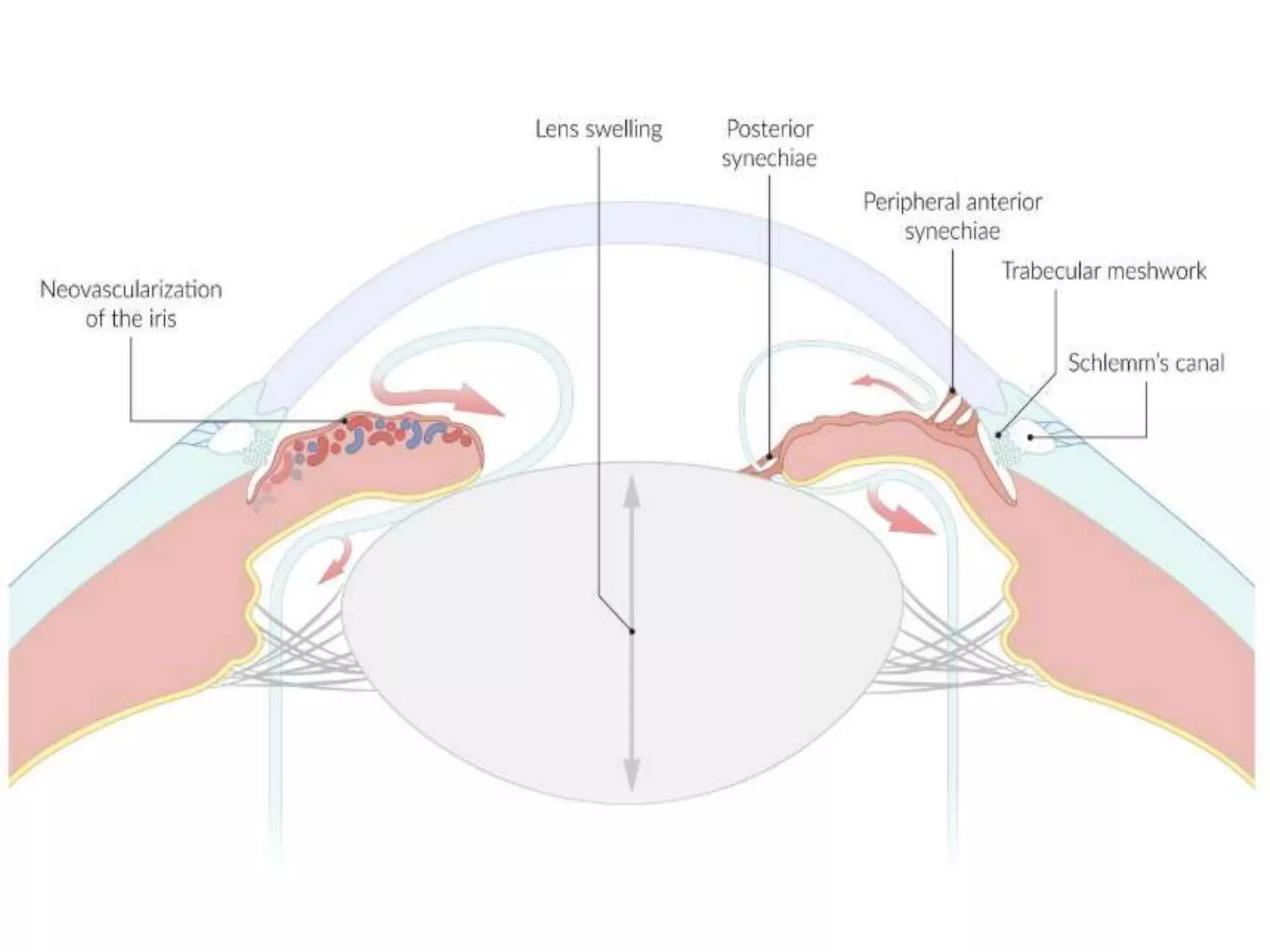 Glaucoma-Relevant Anatomy & Physiology | PPTX