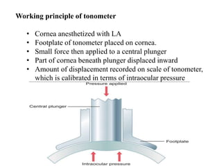 Glaucoma-Relevant Anatomy & Physiology | PPTX
