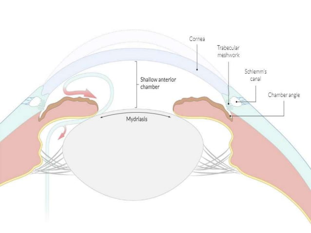 Glaucoma-Relevant Anatomy & Physiology | PPTX | Eye and Vision ...
