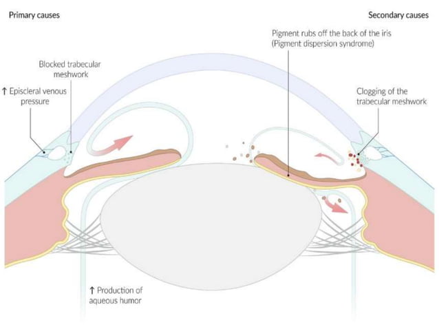 Glaucoma-Relevant Anatomy & Physiology | PPTX | Eye and Vision ...