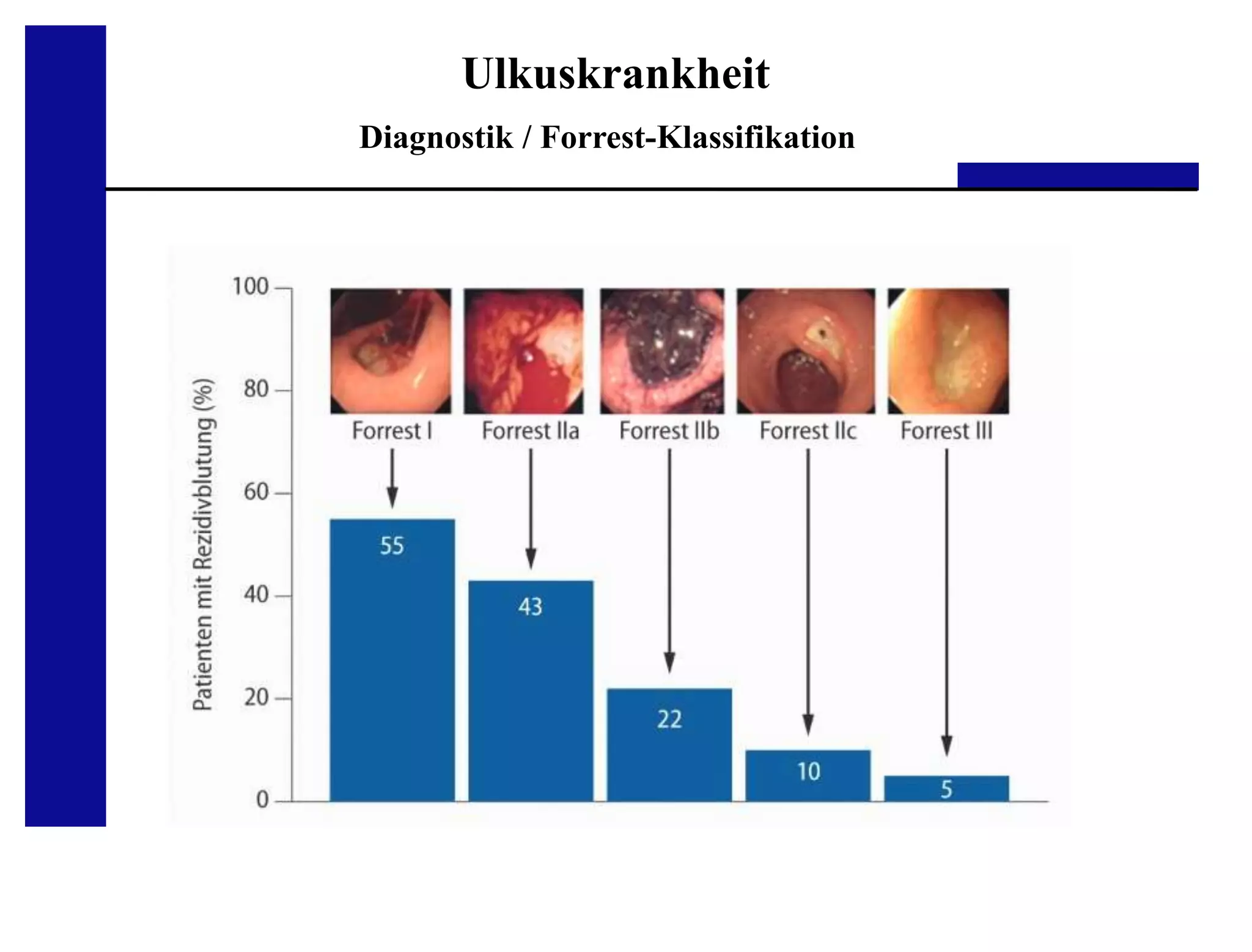 15.107 Magenerkrankungen