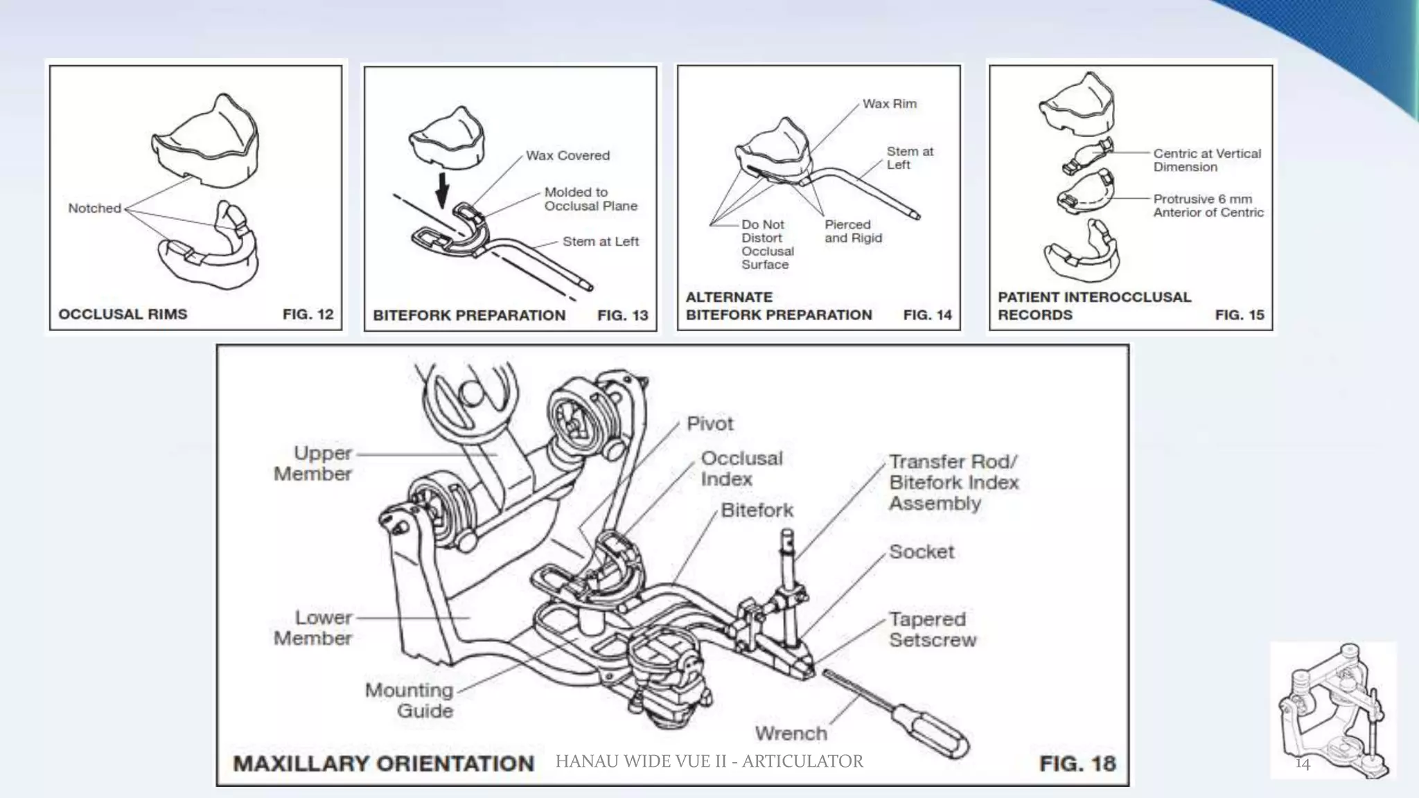 HANAU WIDE VUE II ARTICULATOR | PPTX