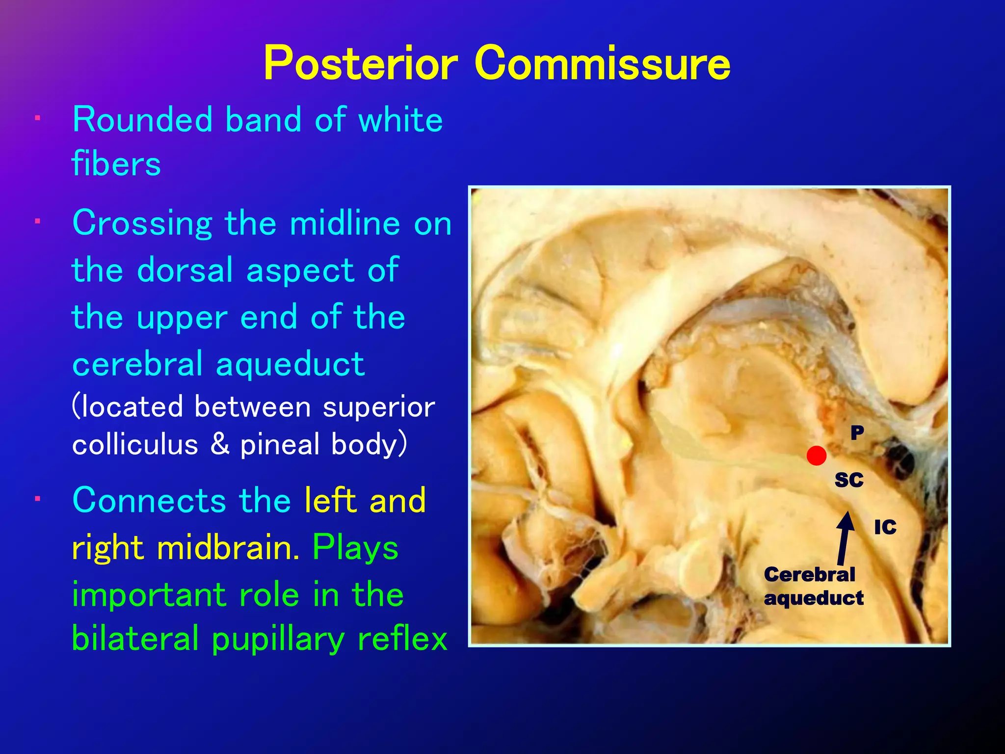 15. White matter cerebrum | PPT