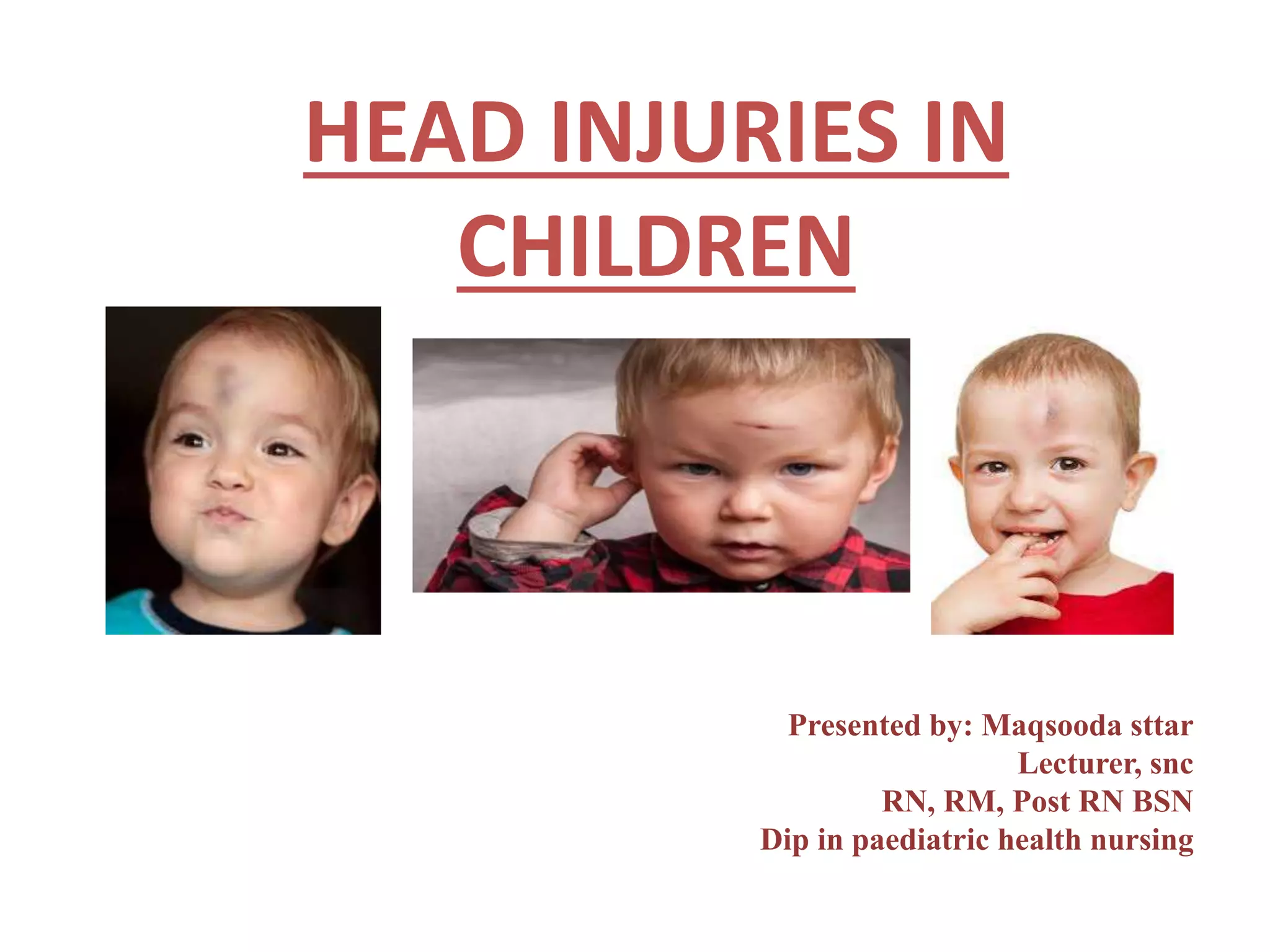 15.8 HEAD INJURY IN CHILD.pptx