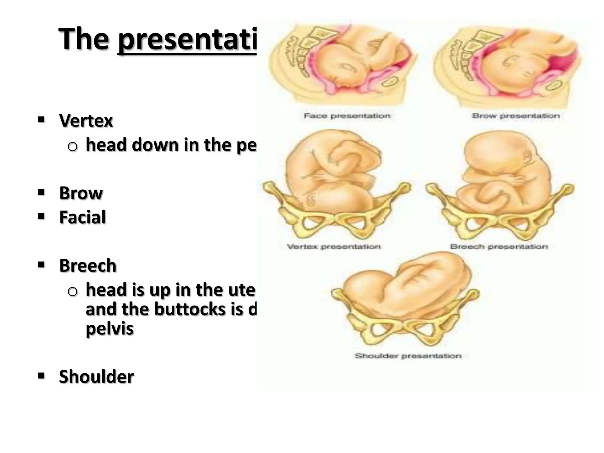 15. LEOPOLD_MANEUVERS.pptx | Pregnancy | Reproductive Health