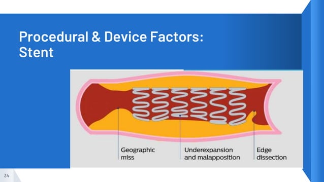 Stent thrombosis & Restenosis.pptx