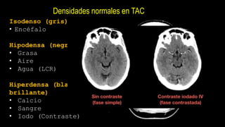 15. Tomografìa Cerebral-202333333333.pptx