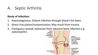 15.Bone and Joint Infections. Types, clinical presentation and ...