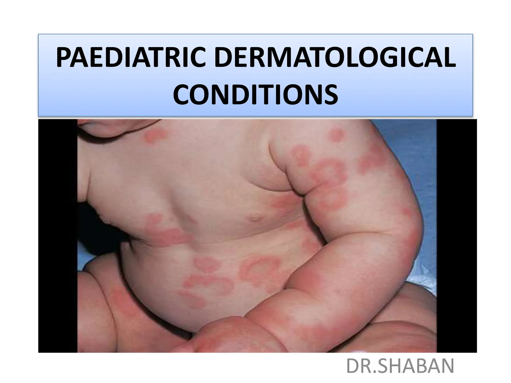 15. PAEDIATRIC DERMATOLOGICAL CONDITIONS(Psoriasis, pytriasis alba ...
