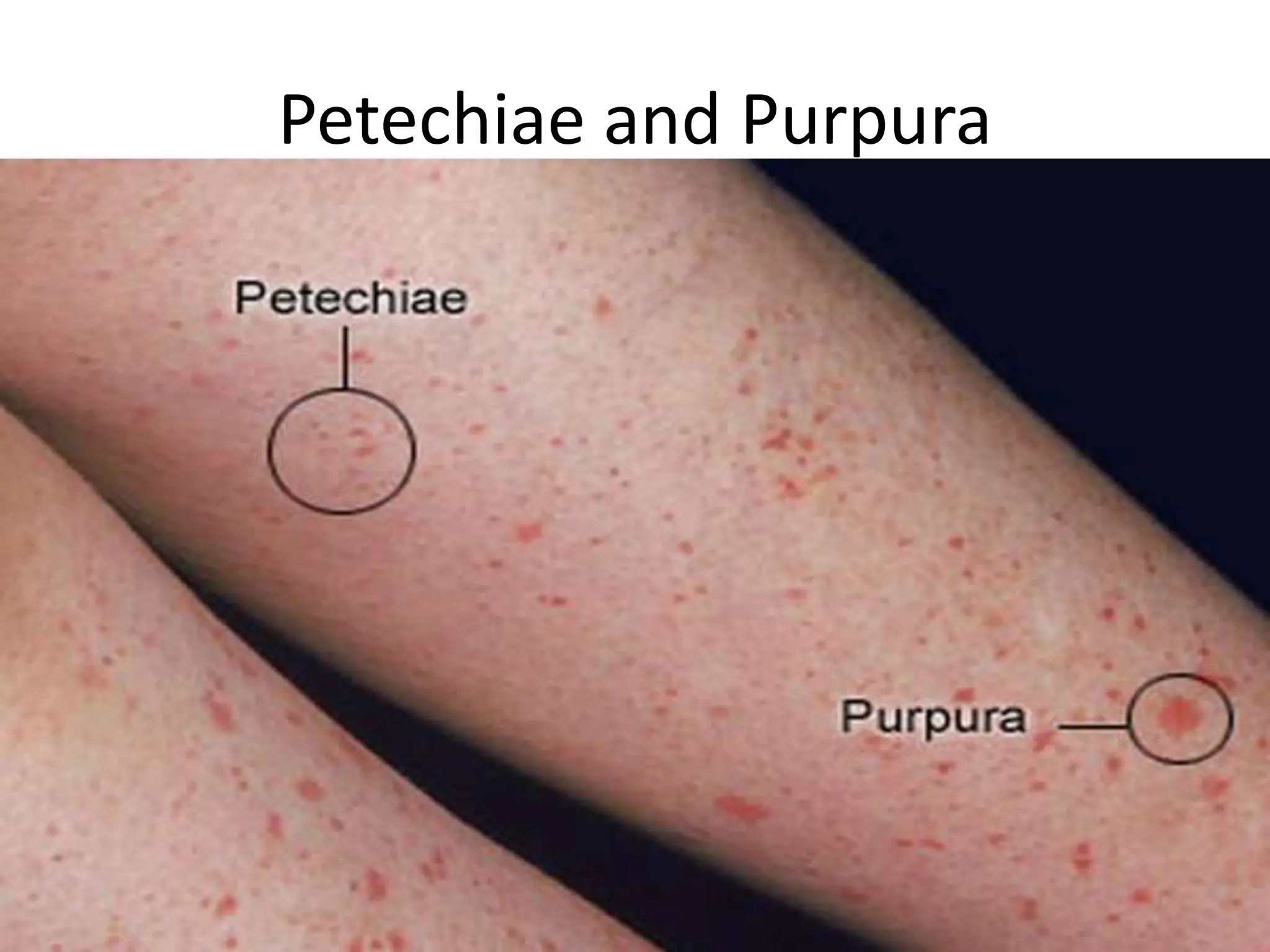 15. PAEDIATRIC DERMATOLOGICAL CONDITIONS(Psoriasis, pytriasis alba ...