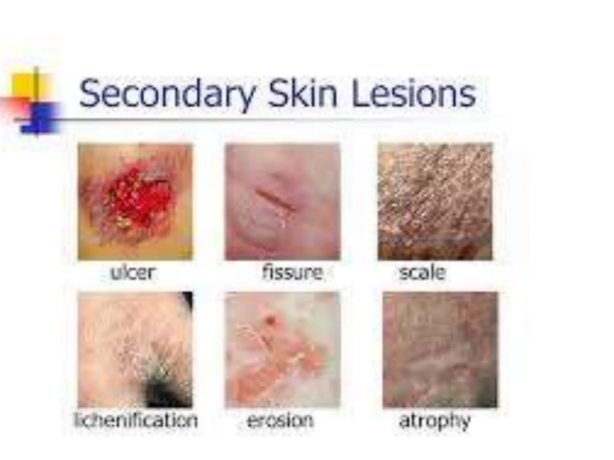 15. PAEDIATRIC DERMATOLOGICAL CONDITIONS(Psoriasis, pytriasis alba ...