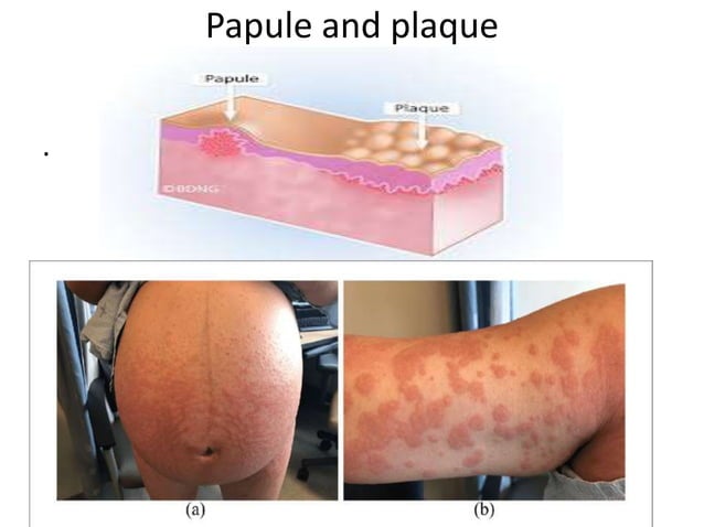 15. PAEDIATRIC DERMATOLOGICAL CONDITIONS(Psoriasis, pytriasis alba ...
