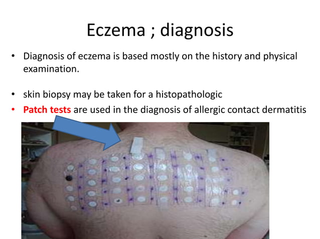 15. PAEDIATRIC DERMATOLOGICAL CONDITIONS(Psoriasis, pytriasis alba ...