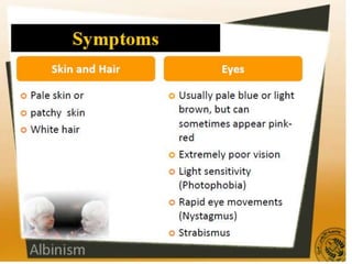 15. PAEDIATRIC DERMATOLOGICAL CONDITIONS(Psoriasis, pytriasis alba ...