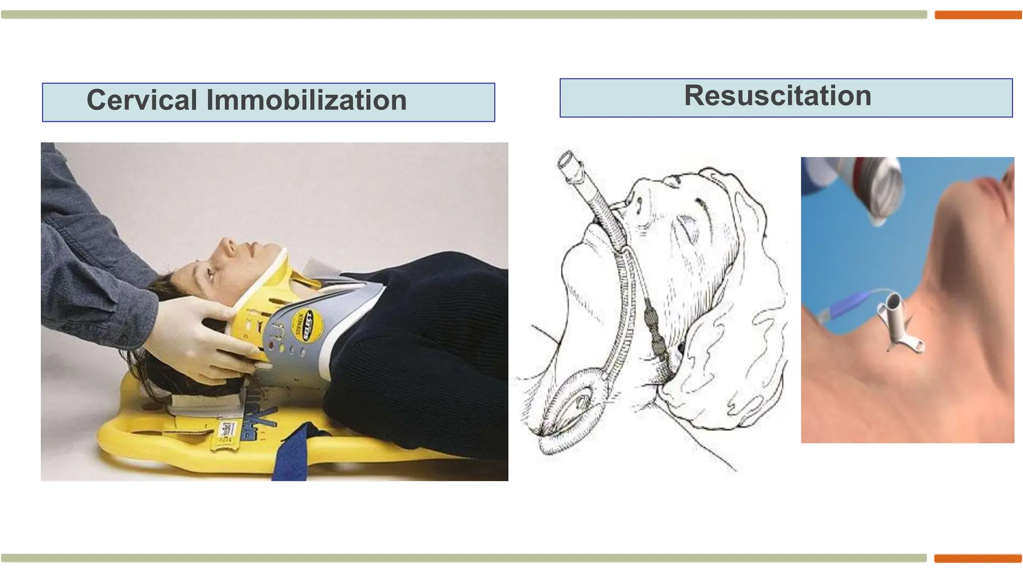 15. Head Trauma & Management (Primary Management Of Head Injury).ppt