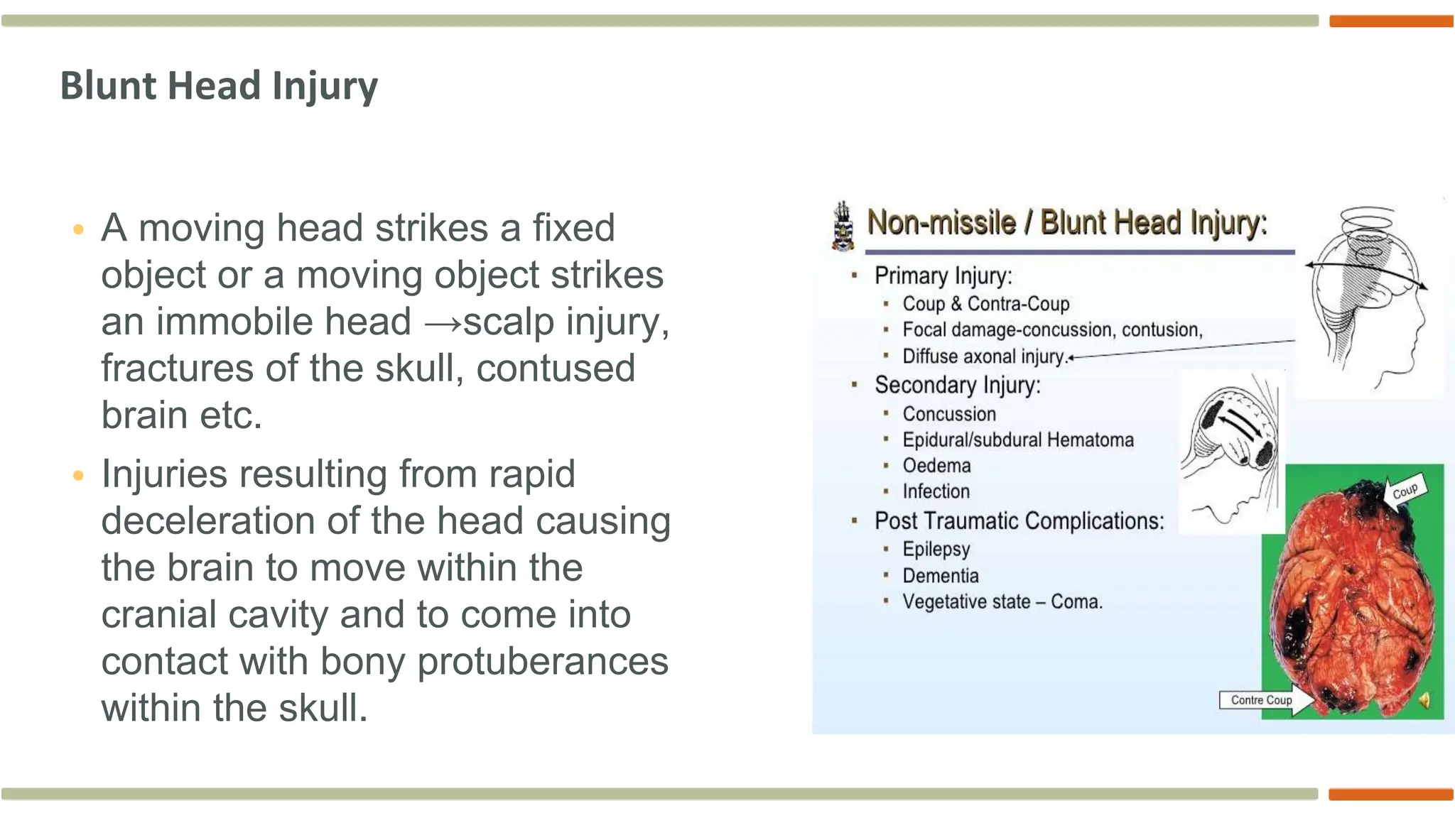 15. Head Trauma & Management (Primary Management Of Head Injury).ppt