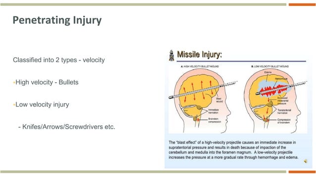 15. Head Trauma & Management (Primary Management Of Head Injury).ppt