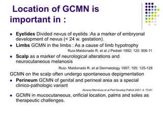 congenital melanocytic nevus diagnosis and treatment | PDF