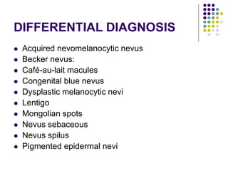 congenital melanocytic nevus diagnosis and treatment | PDF