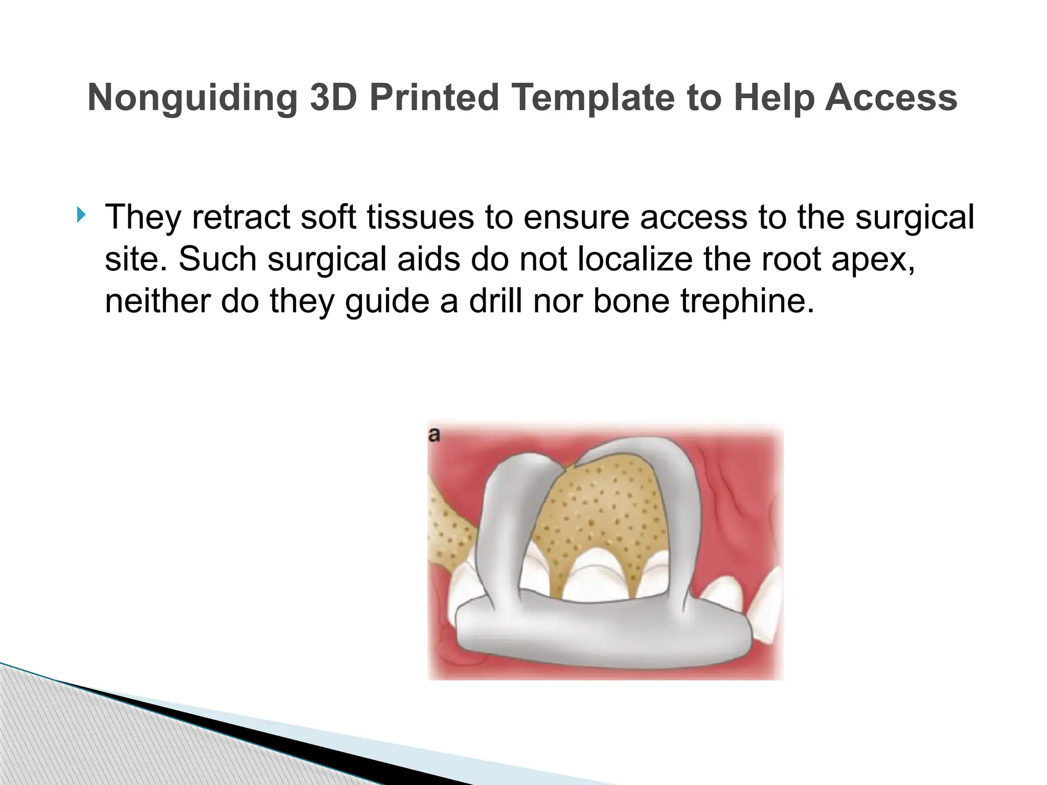 15. guided endodontics important for dental students | PPTX