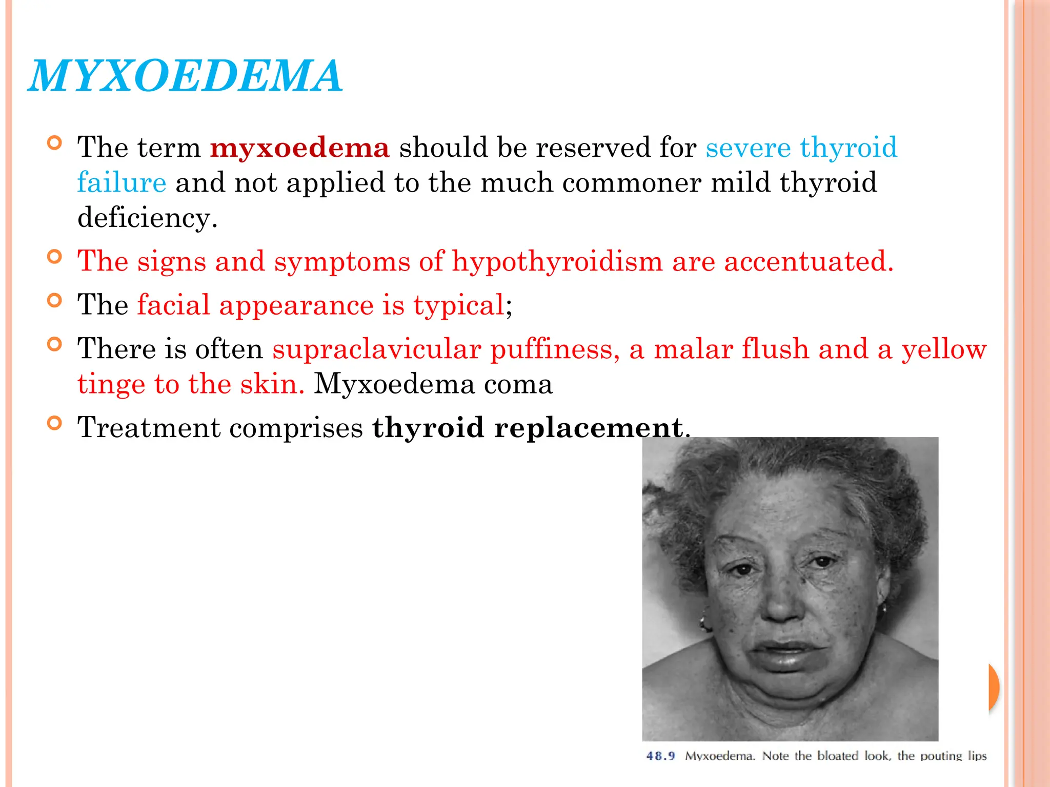 15.Thyroid Diseases ppt...............pptx