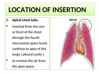15. nursing care with chest drainage system.ppt