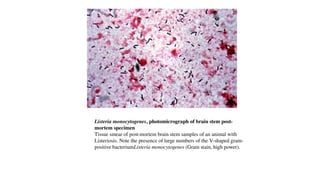 15. Listeriosis.pptxuifiyfiufoufoufoufogi | PPTX