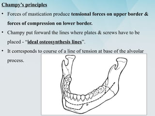 Mandibular Fractures with Management and Complications.pptx