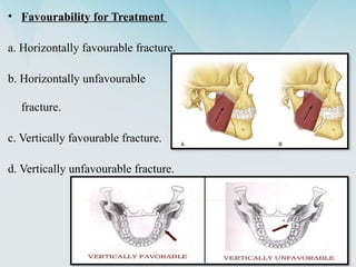 Mandibular Fractures with Management and Complications.pptx