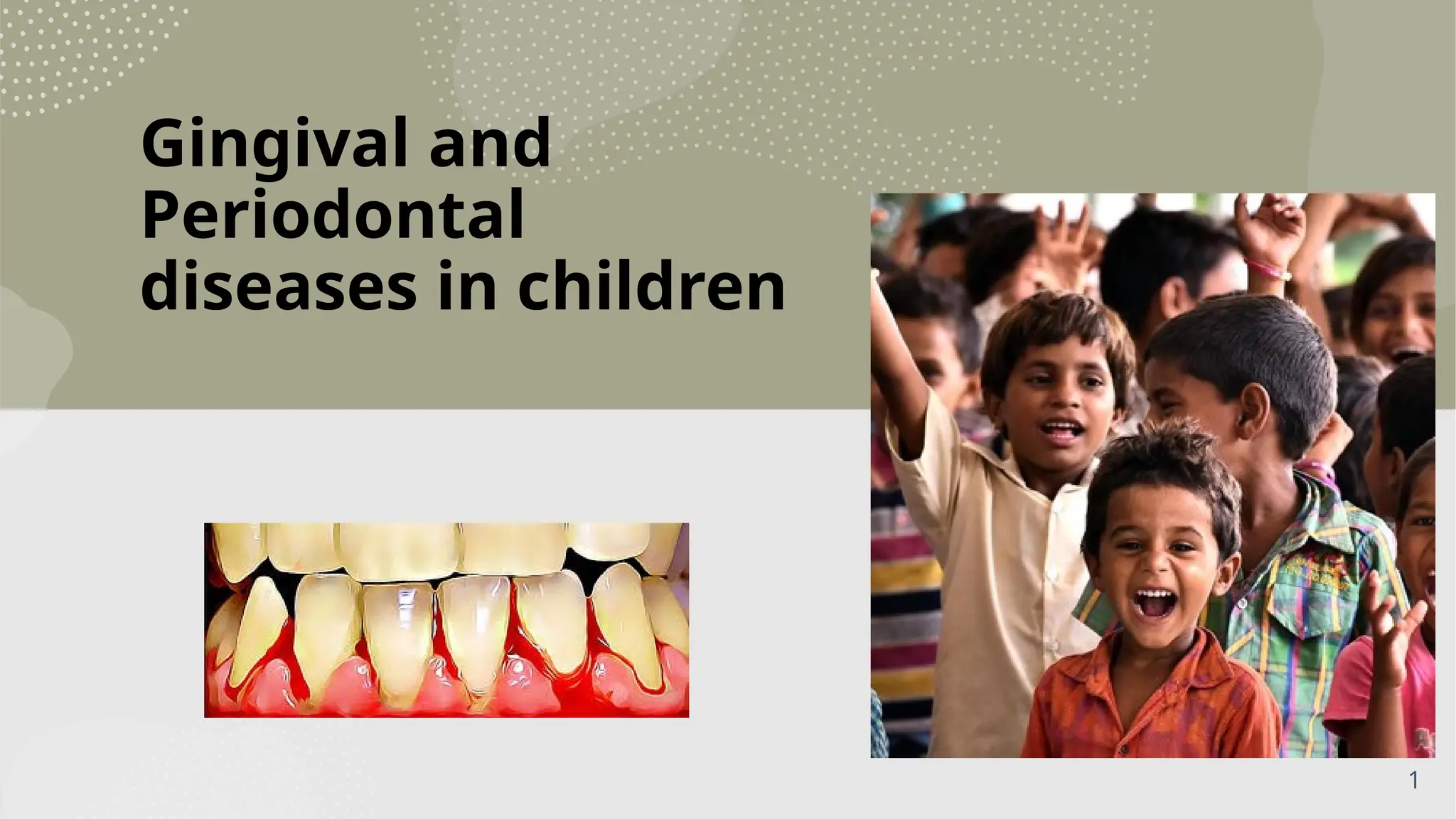Gingival and periodontal diseases in children | PPTX