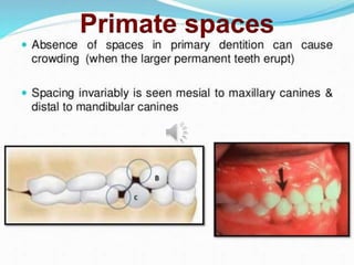 15 arrangements of teeth + curves of occ.audio | PPT