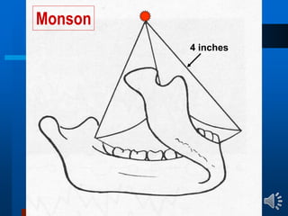 15 arrangements of teeth + curves of occ.audio | PPSX
