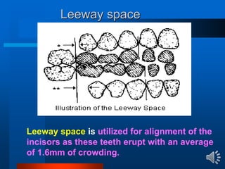 15 arrangements of teeth + curves of occ.audio | PPT