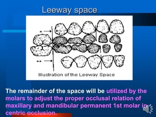 15 arrangements of teeth + curves of occ.audio | PPT