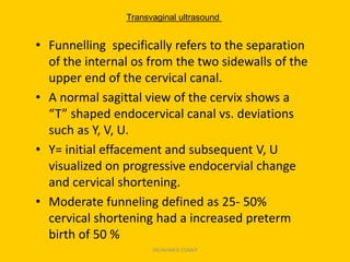 Normal Cervical Os