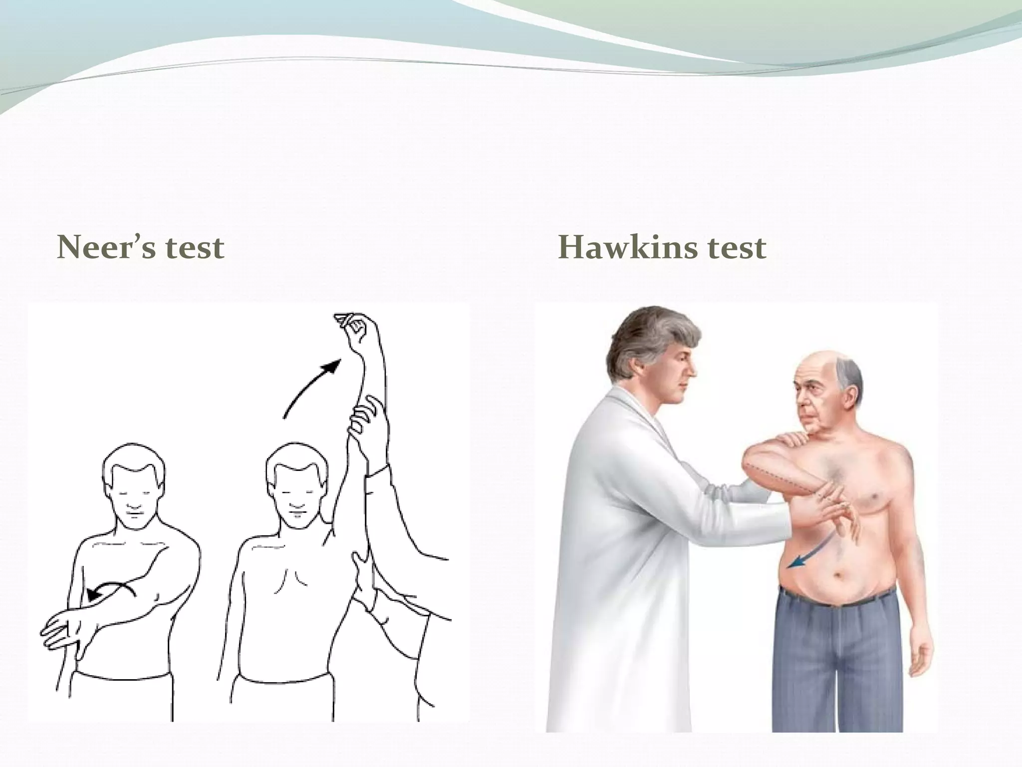 15 common shoulder disorders | PPT